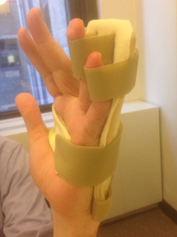 Static Progressive PIP Extension Splint for Finger Fracture/Dislocation ...