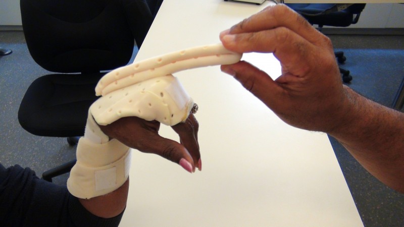 Passive wrist flexion splint | Grand Central Physical Therapy and Hand ...